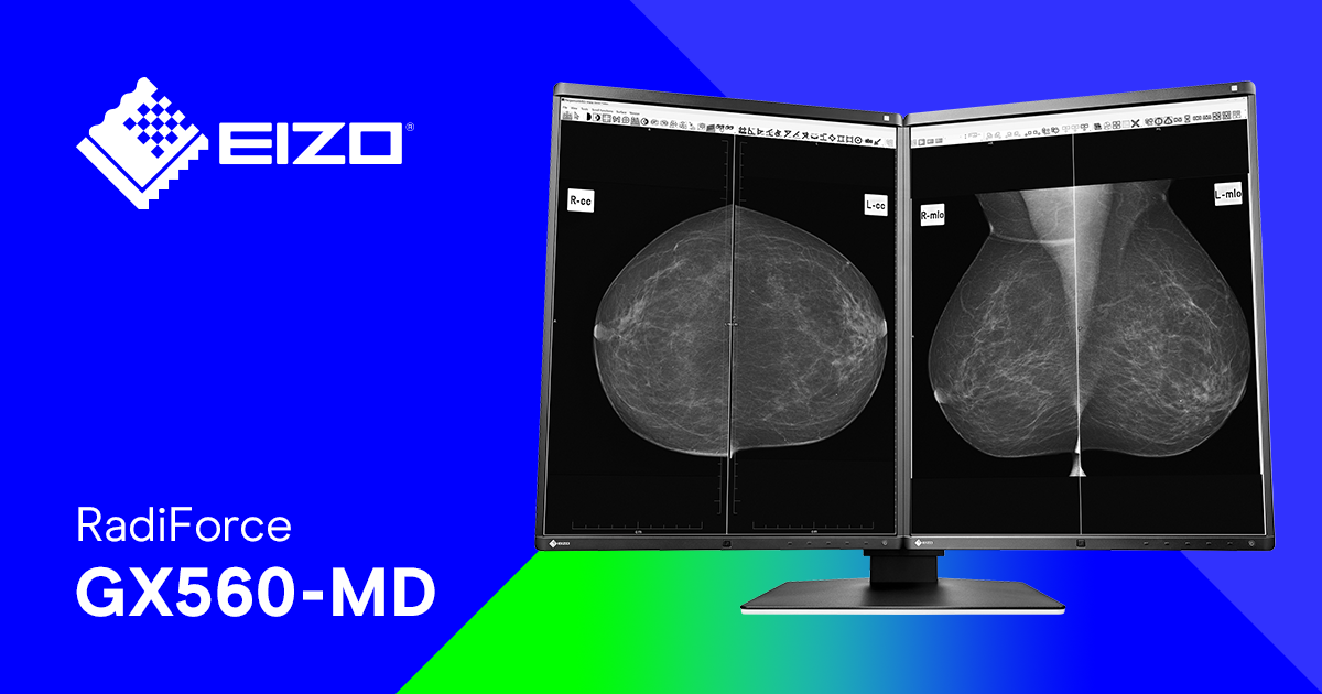 RadiForce GX560-MD | Twee x 5 MP diagnostische monitor